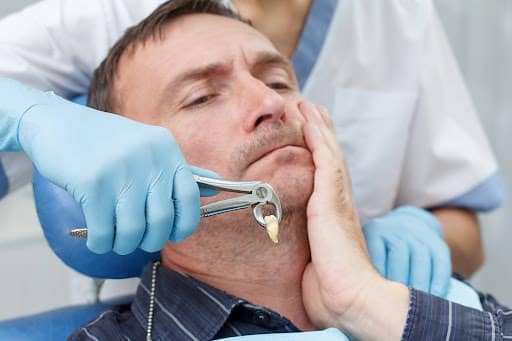 Tooth Extraction Recovery Ukiah CA | Park Falls Dental